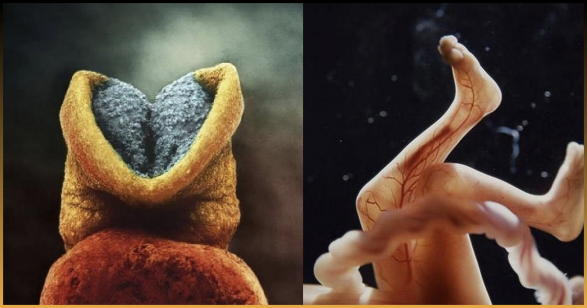 Incredible Photographs Showing Every Stage Of How A Child Is Born