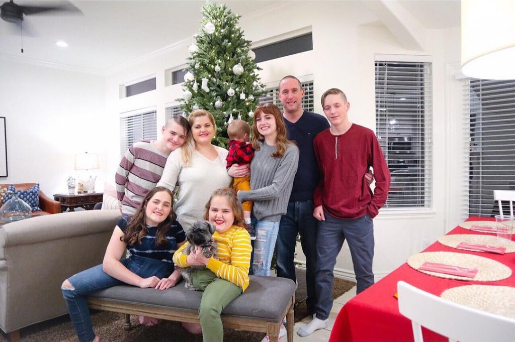 Conjoined Twins Are Separated After Surgery That Leaves Them With One ...