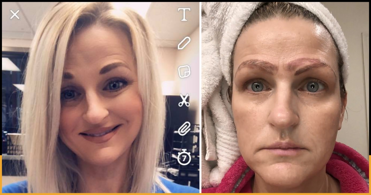 Woman Got Dumped After Botched Treatment Left Her With Four Eyebrows