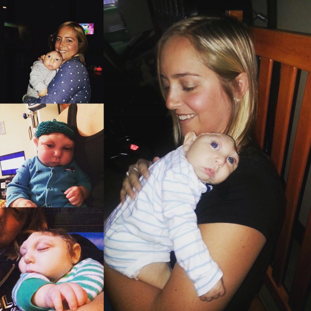 Baby Born With Just 20% Of Brain Proves To Be A 'Miracle Child ...