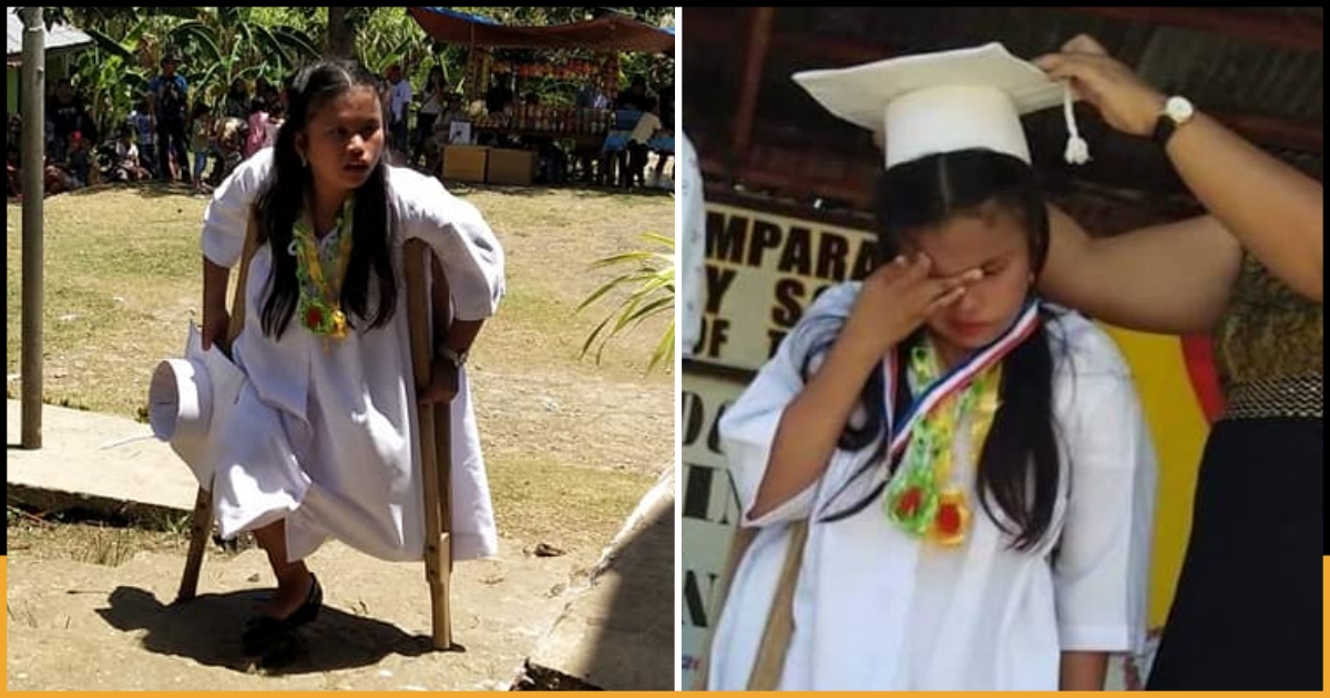 Girl With One Leg In Philippines Completed School By Walking, Becomes ...
